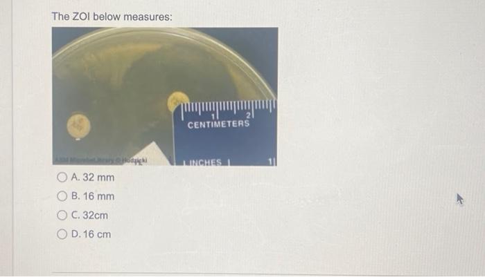 Solved The ZOI below measures: A. 32 mm B. 16 mm | Chegg.com