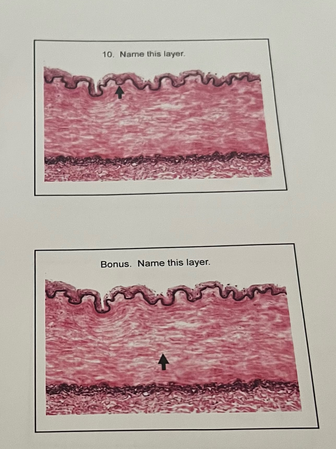 Solved Name this layer.Bonus. Name this layer.• | Chegg.com
