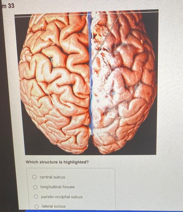 Solved m 33 Which structure is highlighted? central sulous | Chegg.com