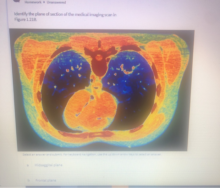 Solved Homework. Unanswered Identify the plane of section of | Chegg.com