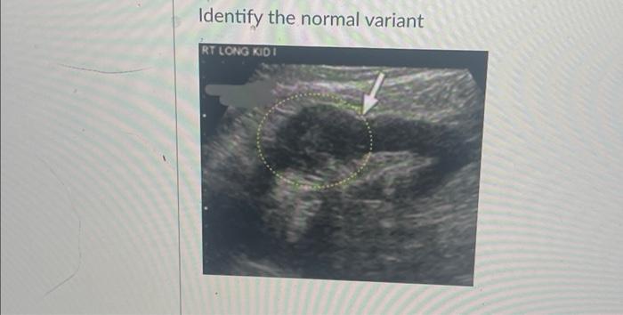 Identify the normal variant | Chegg.com