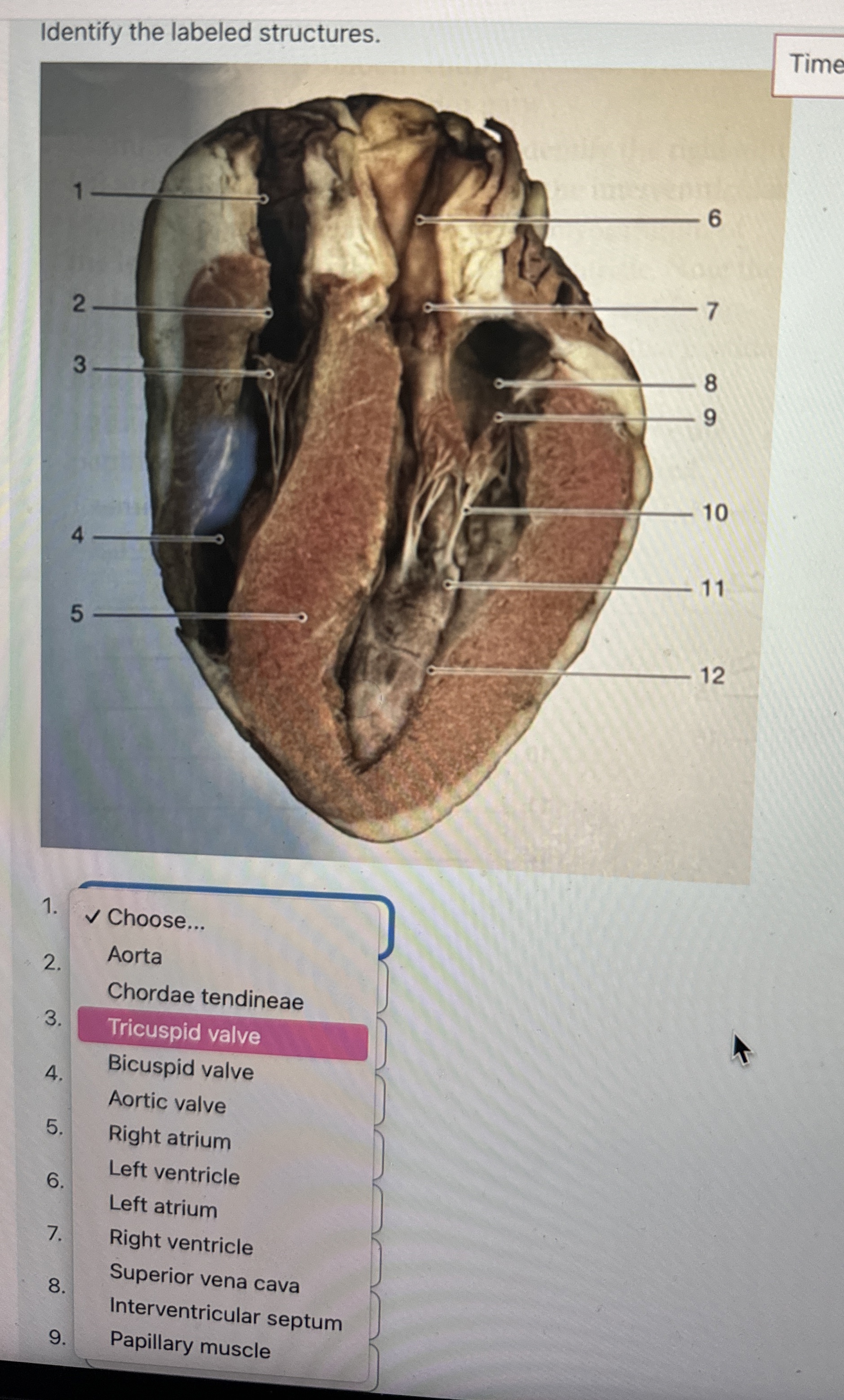 Solved Identify the labeled structures. | Chegg.com