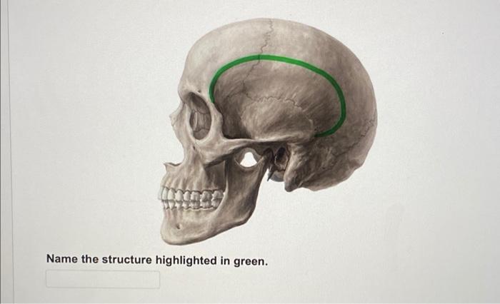 Solved Name the structure highlighted in green. | Chegg.com
