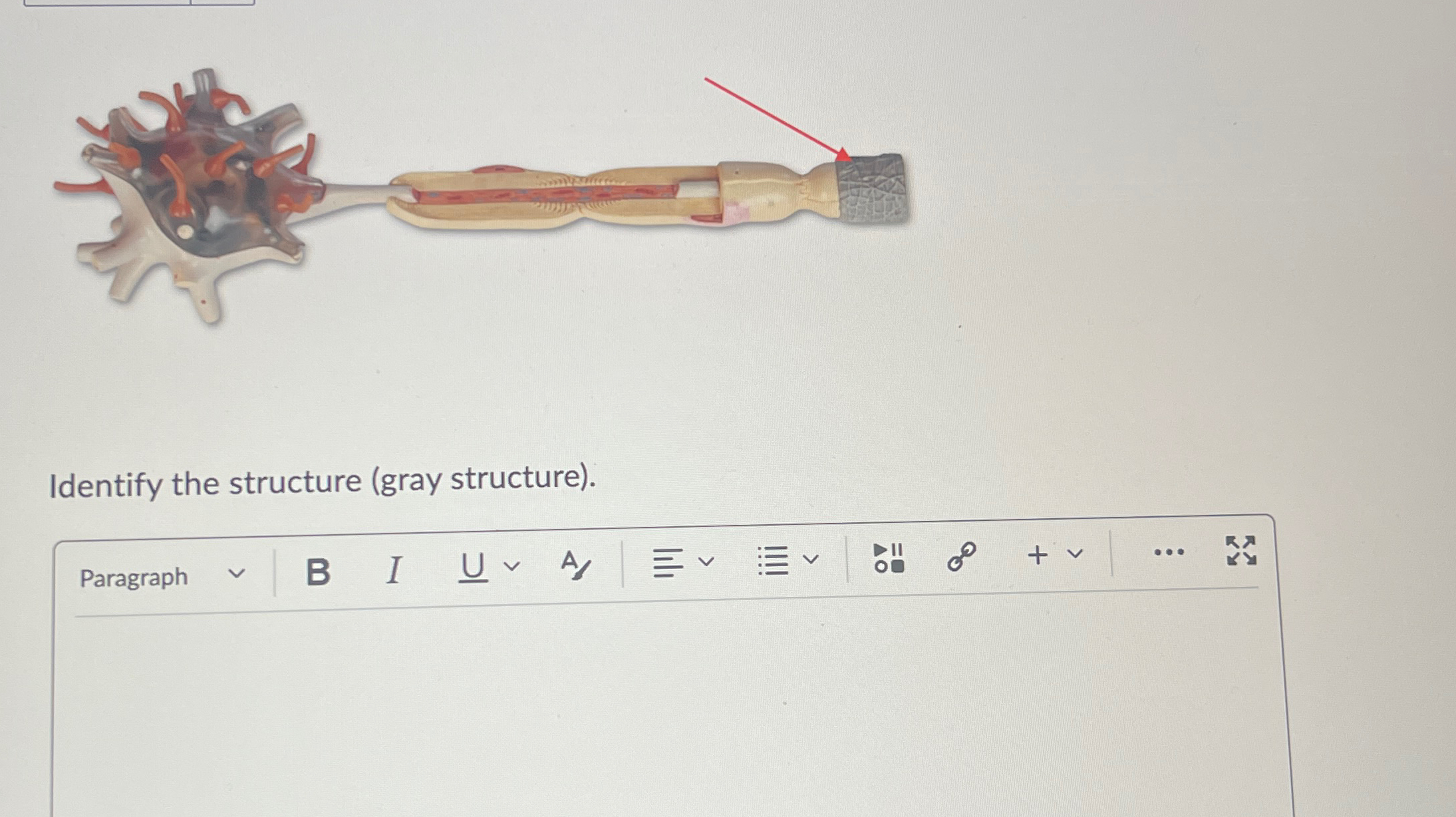 Solved Identify the structure (gray | Chegg.com