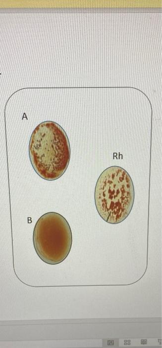 Solved A 쯤 Rh 00 B A Rh B | Chegg.com