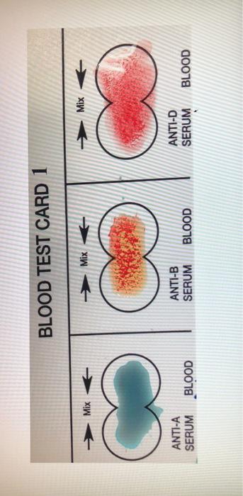 Solved can you please interpret this blood test card. | Chegg.com