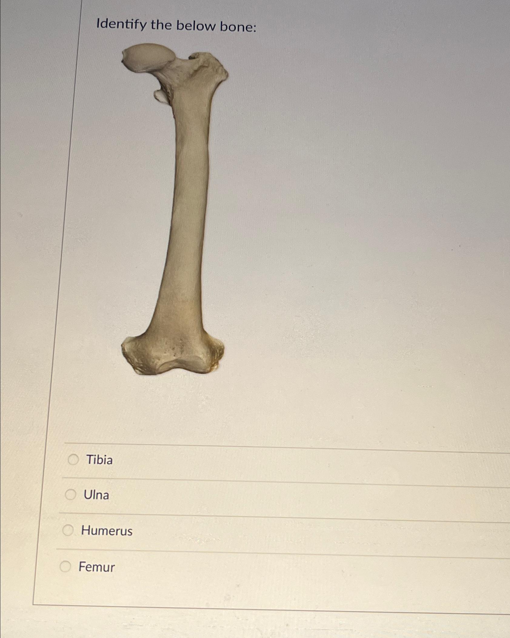 Solved Identify the below bone:TibiaUlnaHumerusFemur | Chegg.com
