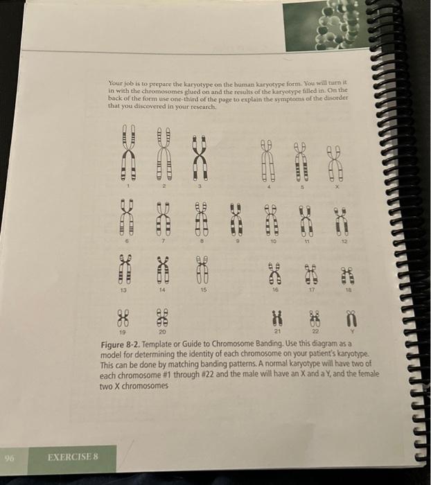 Solved Your fob is to prepare the karyotype on the human | Chegg.com