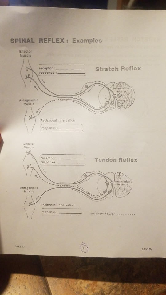 Solved SPINAL REFLEX: Examples Effector Muscle receptor: | Chegg.com