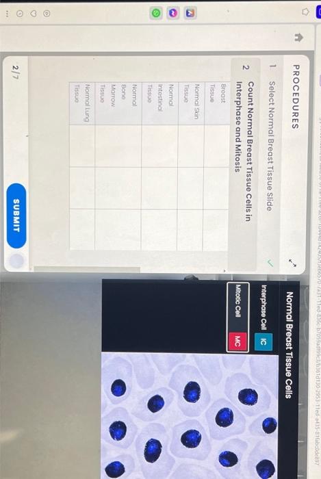 PROCEDURES 1 Select Normal Breast Tissue Slide Count | Chegg.com