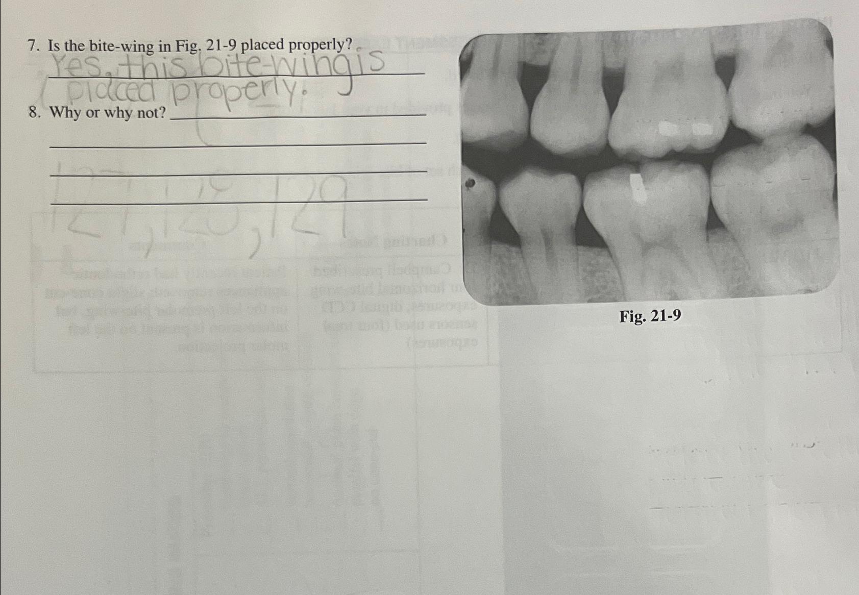 Solved Is the bite-wing in Fig. 21-9 ﻿placed properly?Why or | Chegg.com