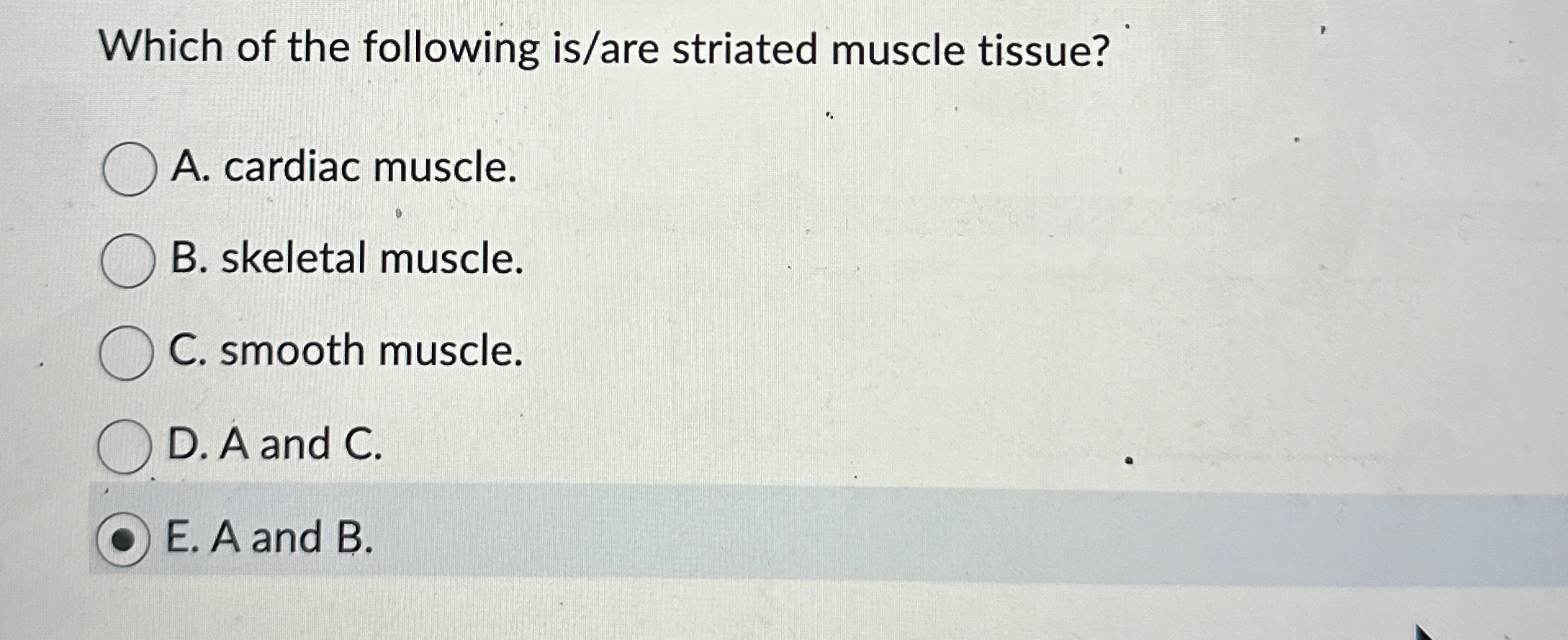 Solved Which of the following is/are striated muscle | Chegg.com