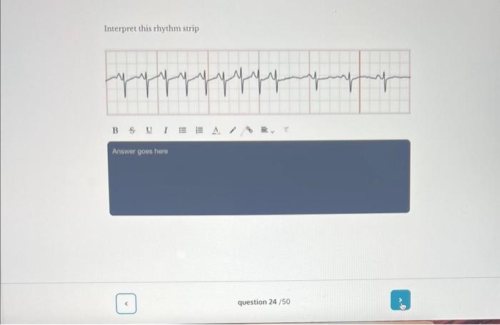 Solved Interpret this rhythm strip Interpret this rhythm | Chegg.com