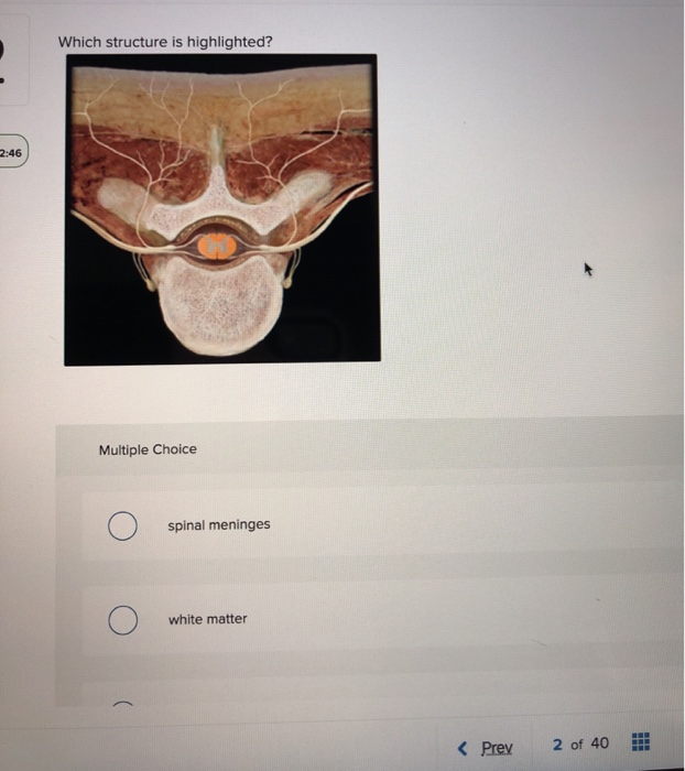 Solved Which structure is highlighted? 2:46 Multiple Choice | Chegg.com