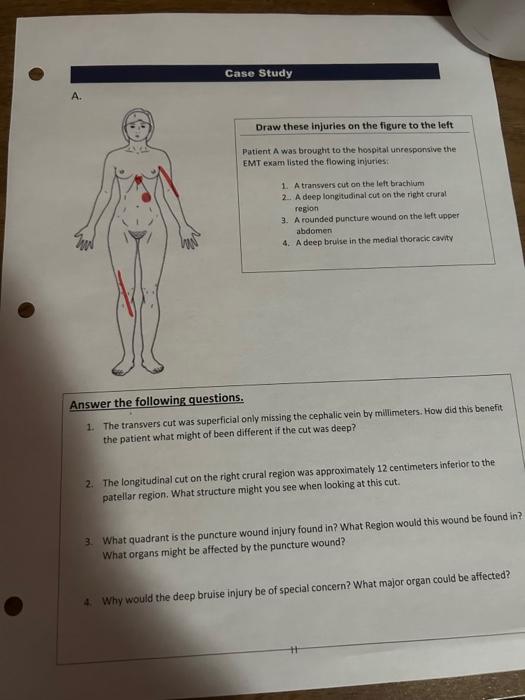 Solved Case Study A. Draw these injuries on the figure to | Chegg.com