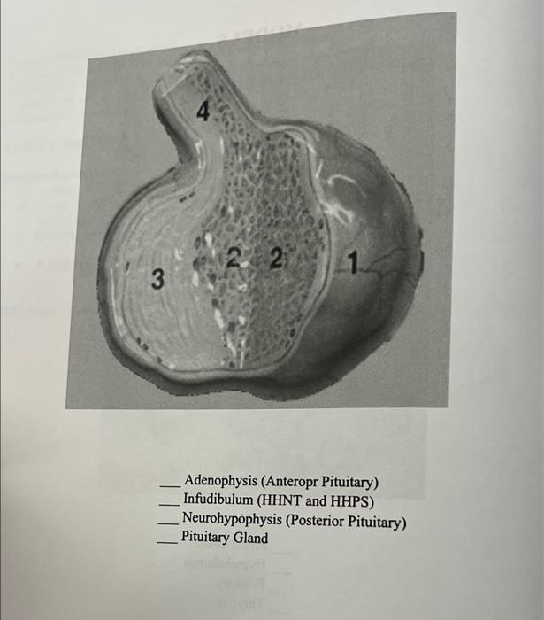 Solved 22 1 3 Adenophysis (Anteropr Pituitary) Infudibulum | Chegg.com