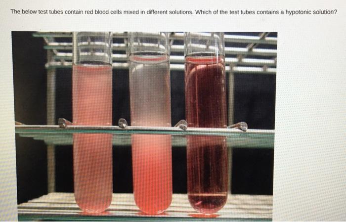 Solved The below test tubes contain red blood cells mixed in | Chegg.com