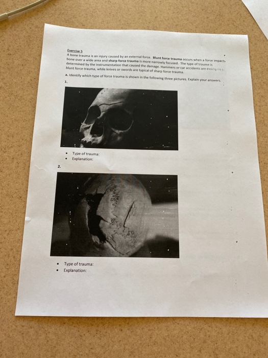 Solved Exercises A bone trauma is an injury caused by an | Chegg.com