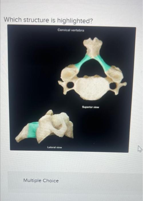 Which structure is hiahliahted? Multiple | Chegg.com