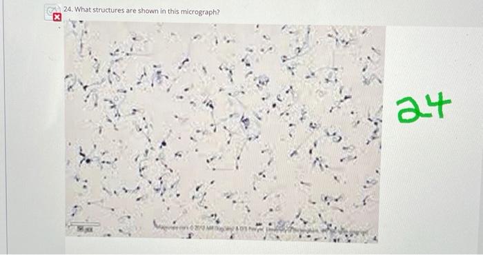 Solved 24. What structures are shown in this micrograph? au | Chegg.com