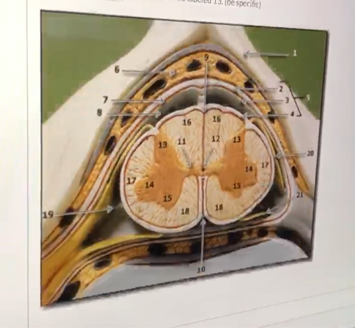 Solved 21- identify the space labeled 8: Identify 4:22- | Chegg.com