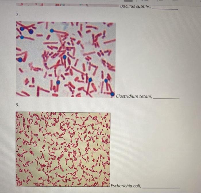 Solved A. Look at the following micrograph and identify the | Chegg.com