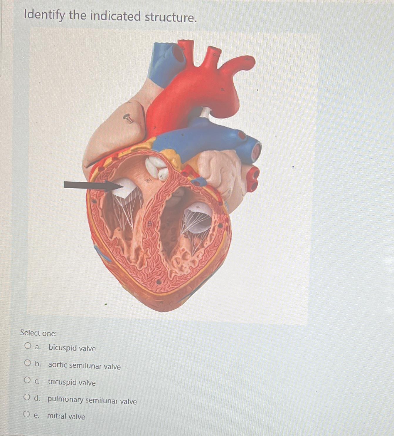 Solved Identify the indicated structure.Select one:a. | Chegg.com