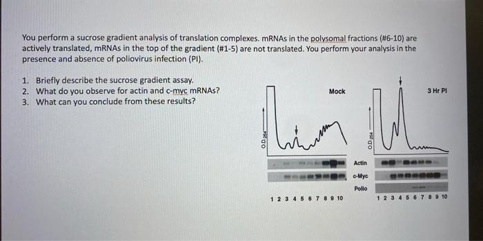Solved You perform a sucrose gradient analysis of | Chegg.com