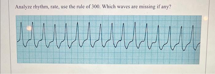 Solved Analyze rhythm, rate, use the rule of 300 . Which | Chegg.com