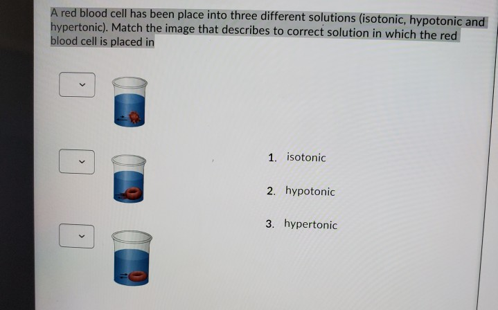 Solved A red blood cell has been place into three different | Chegg.com