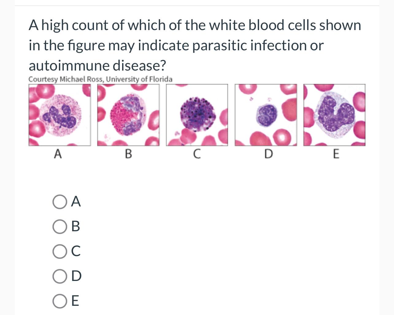 Solved A high count of which of the white blood cells shown | Chegg.com