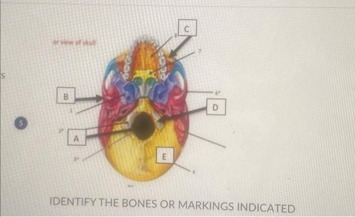 Solved IDENTIFY THE BONES OR MARKINGS INDICATED | Chegg.com