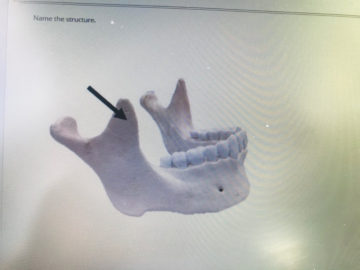Solved name the structurea. left condylar processb. left | Chegg.com