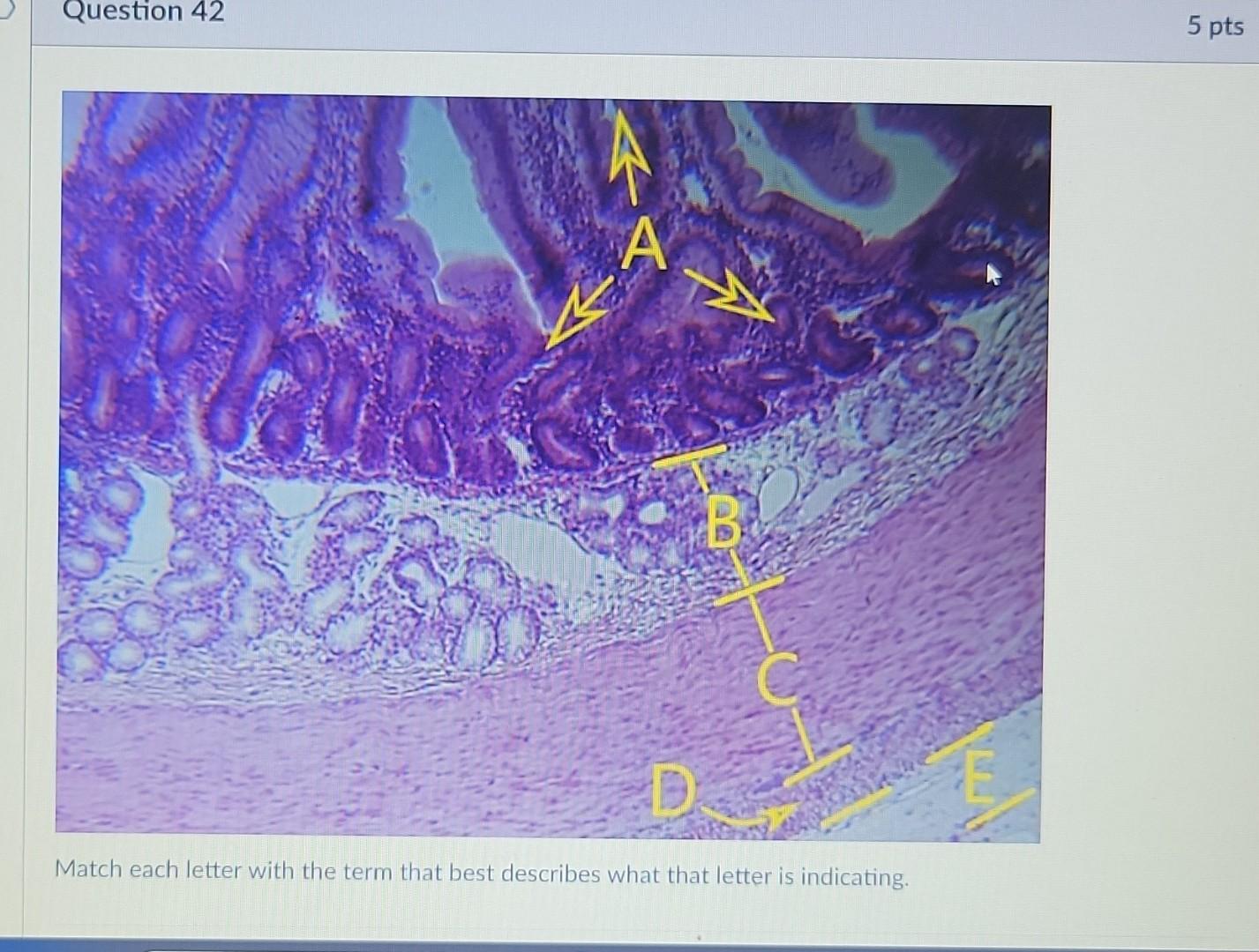 Question 42 Match each letter with the term that best | Chegg.com