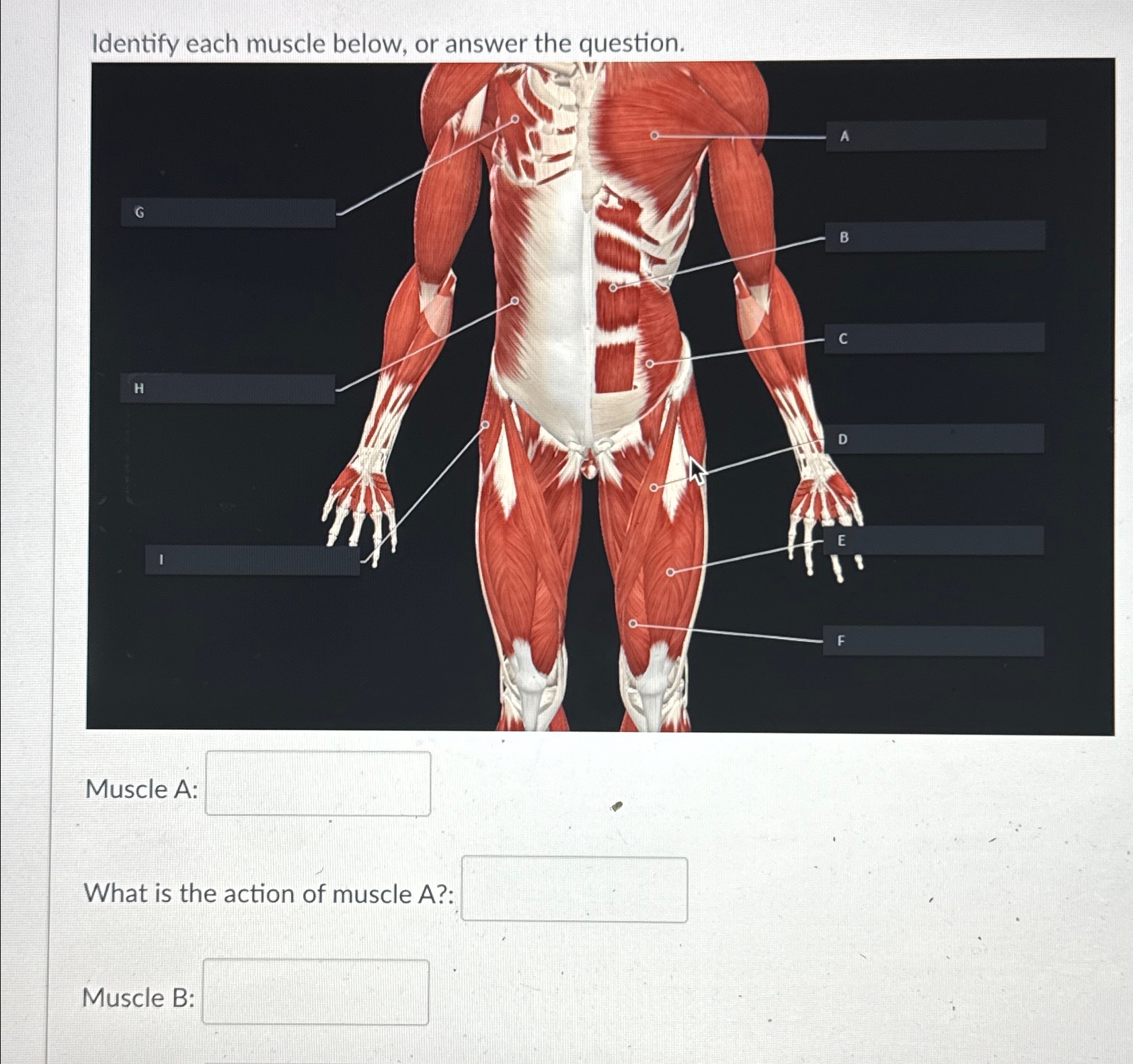 Solved Identify each muscle below, or answer the | Chegg.com