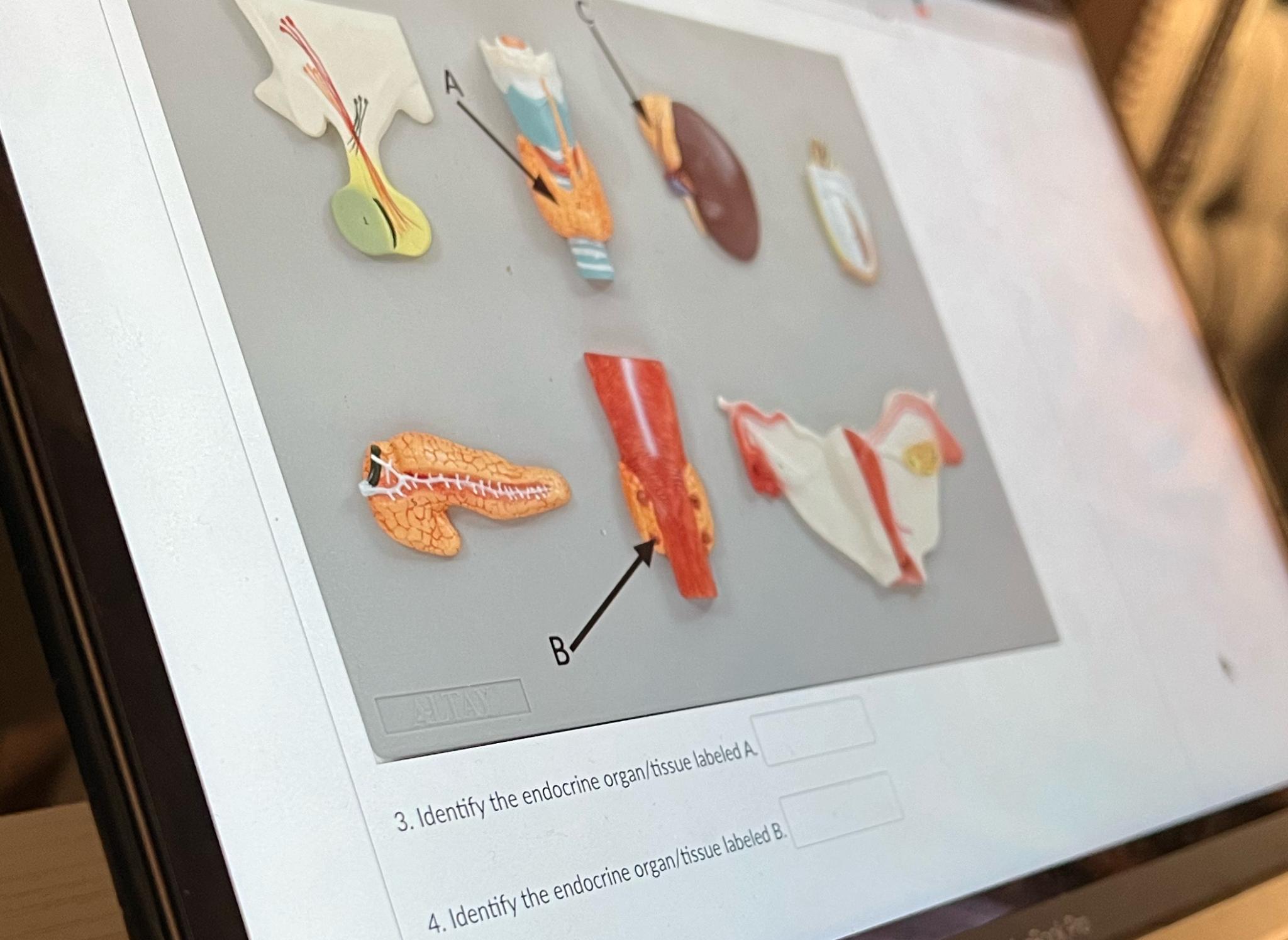 Solved Identify the endocrine organ tissue labeled AIdentify | Chegg.com