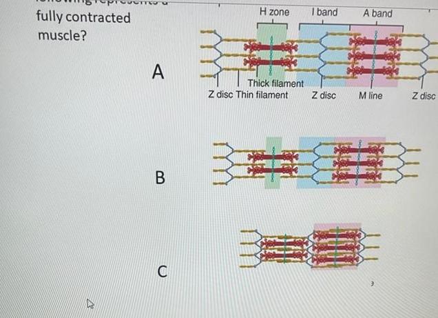 Solved H zone I band A band fully contracted muscle? A Thick | Chegg.com