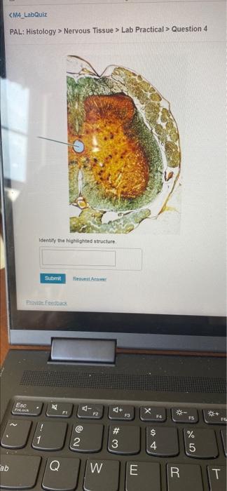 Solved ab Nervous Tissue > Lab Practical > Question 4 | Chegg.com