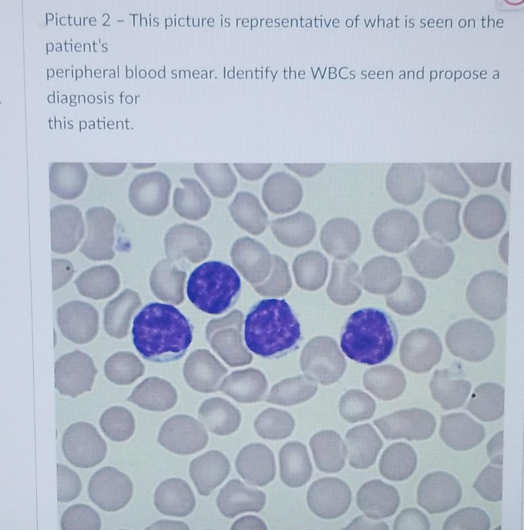 Solved Picture 2 - This picture is representative of what is | Chegg.com
