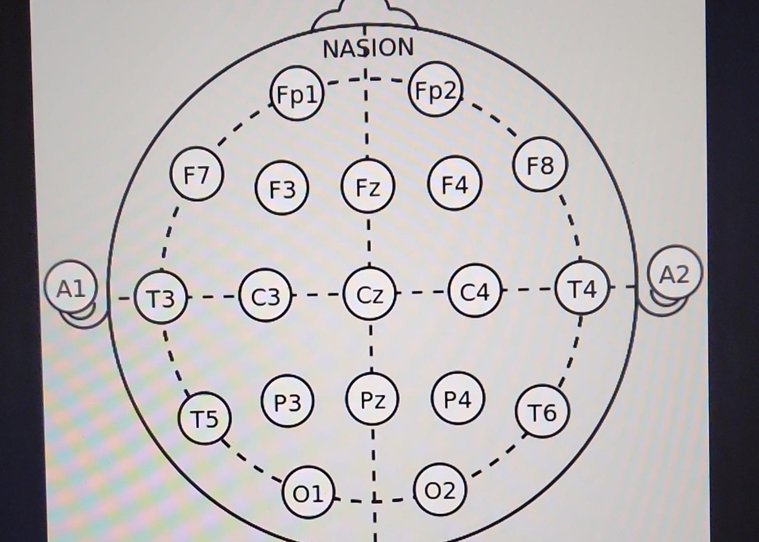 For EEG signal that was samplwd at 512 Hz, the signal | Chegg.com