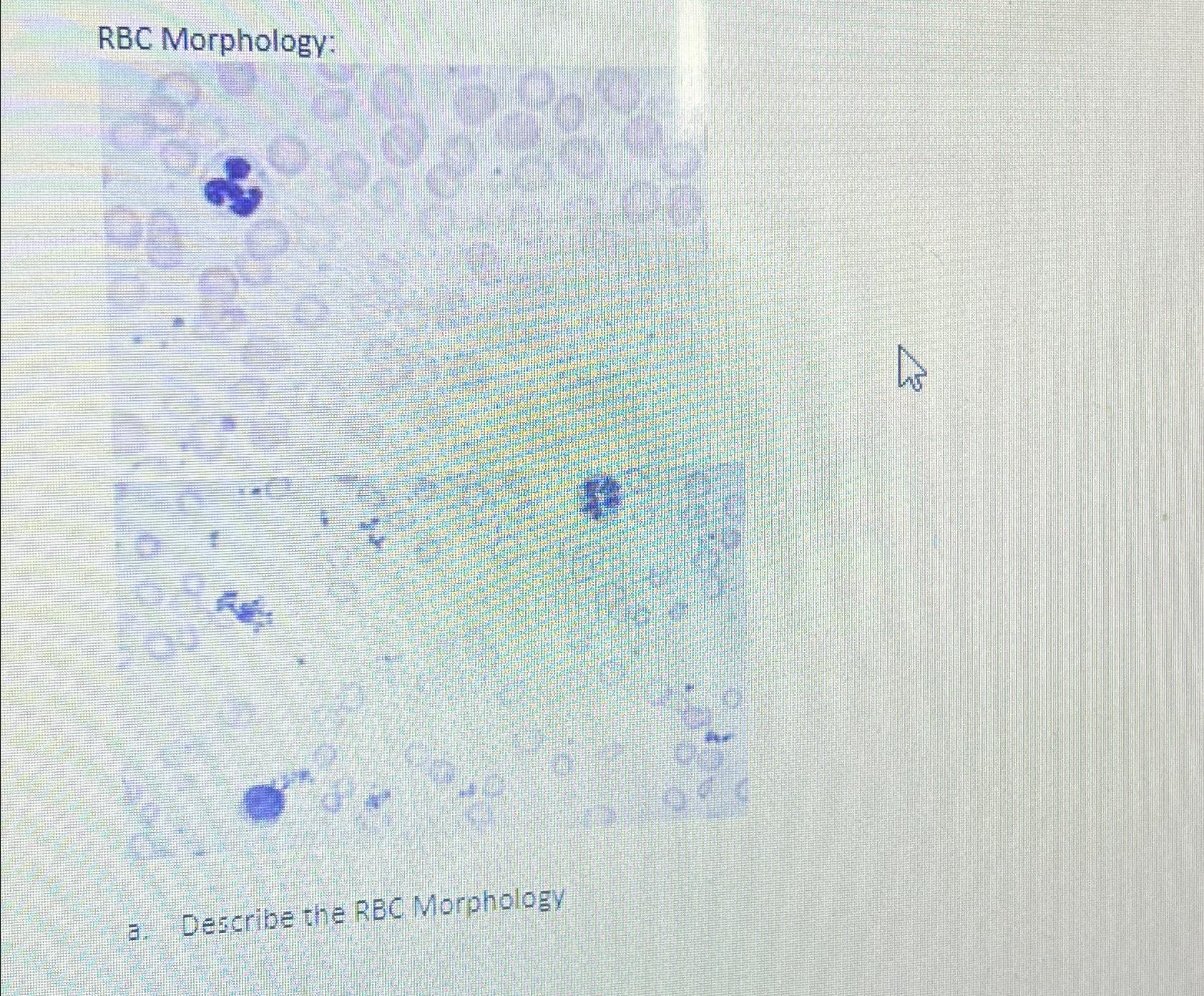 Solved RBC Morphology:a. ﻿Describe the RBC Morphology Using | Chegg.com