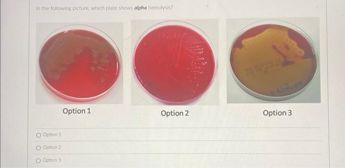 Solved In the following picture, which plate shows alpha | Chegg.com