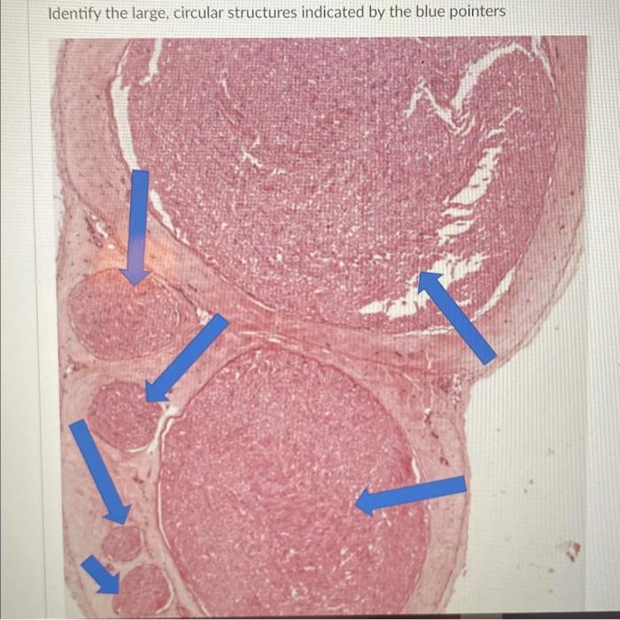 Solved Identify the large, circular structures indicated by | Chegg.com