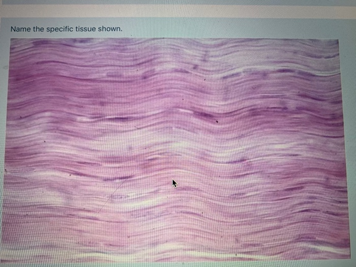 Solved Name the specific tissue shown in the top layer of | Chegg.com
