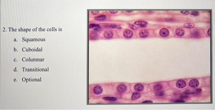 Solved 1. The shape of the cells is a. Squamous b. Cuboidal | Chegg.com