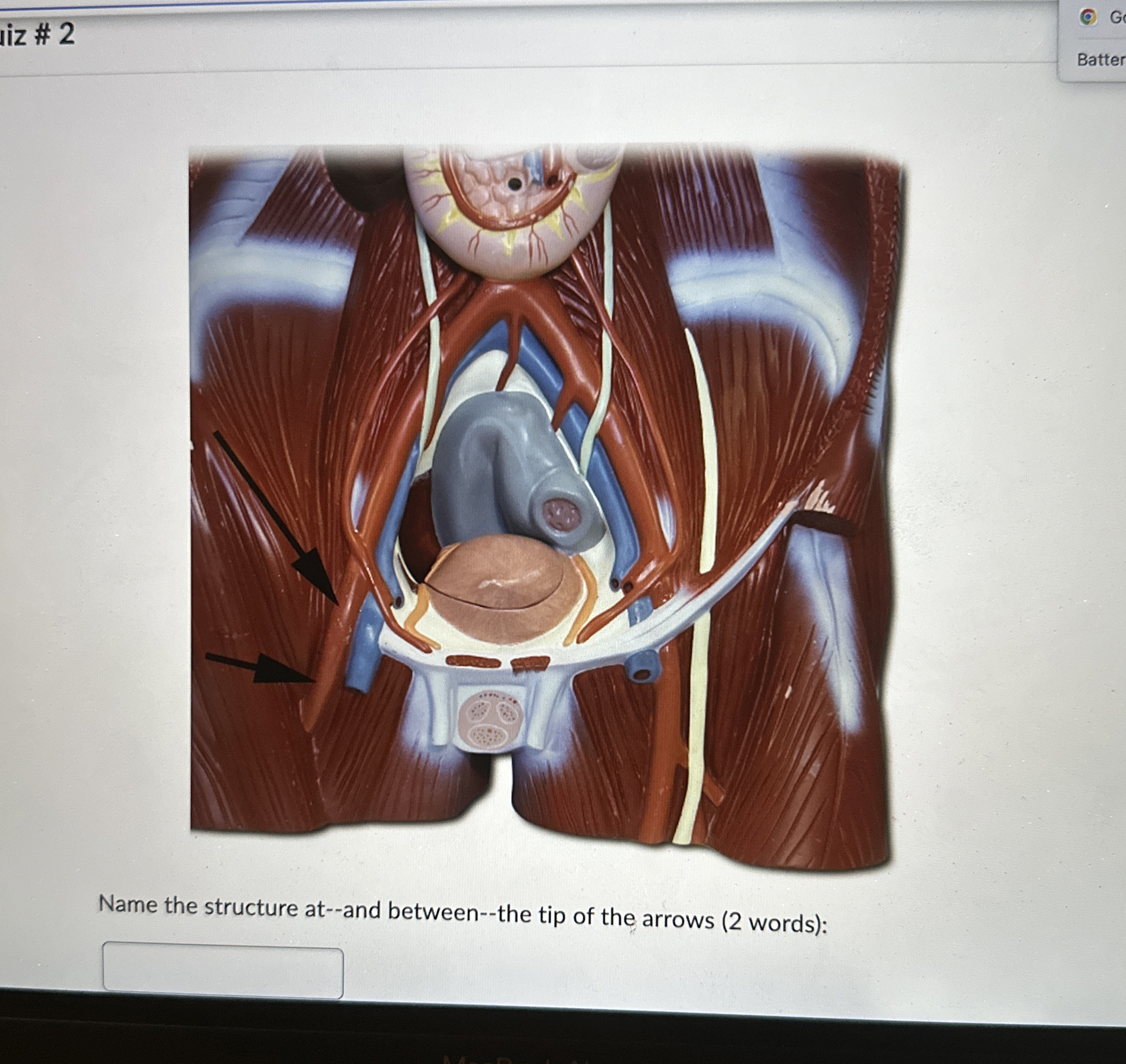 Solved iz # 2Name the structure at--and between--the tip of | Chegg.com