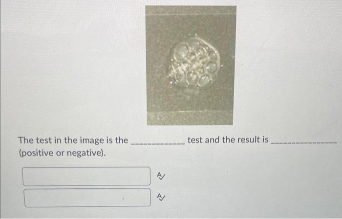 Solved The test in the image is the test and the result is | Chegg.com