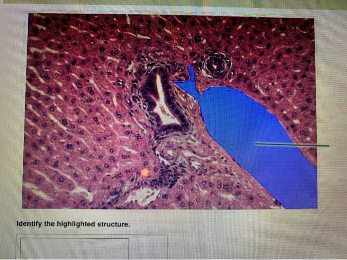 Solved Identify the highlighted structure. | Chegg.com