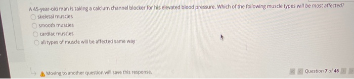 Question 4 The latch phenomenon observed in smooth | Chegg.com