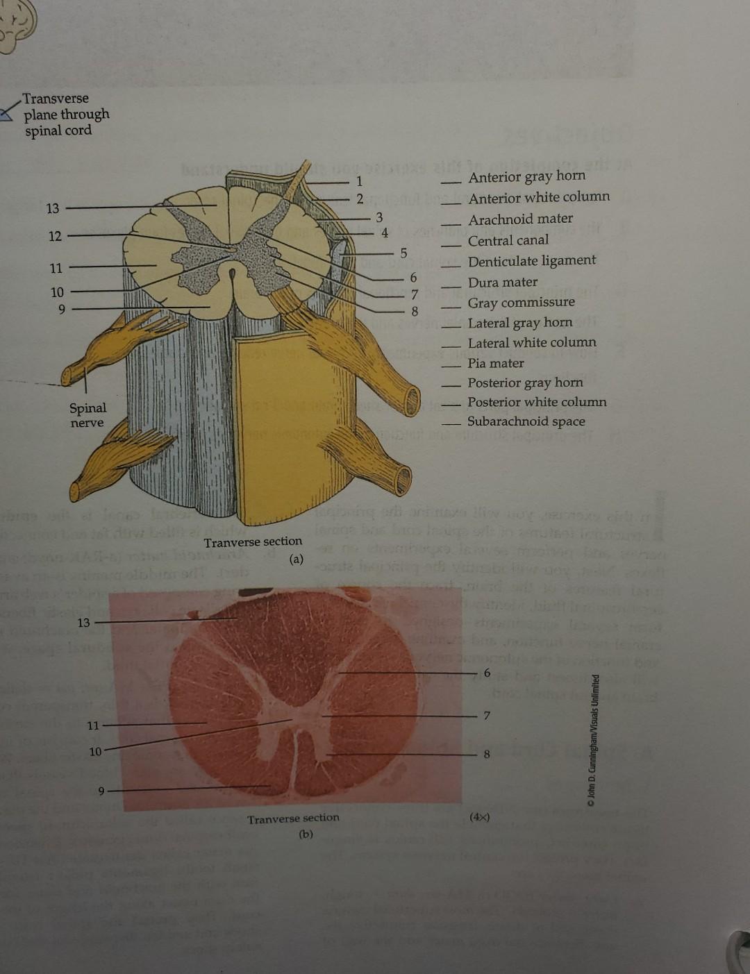Transverse plane through spinal cord Anterior gray | Chegg.com